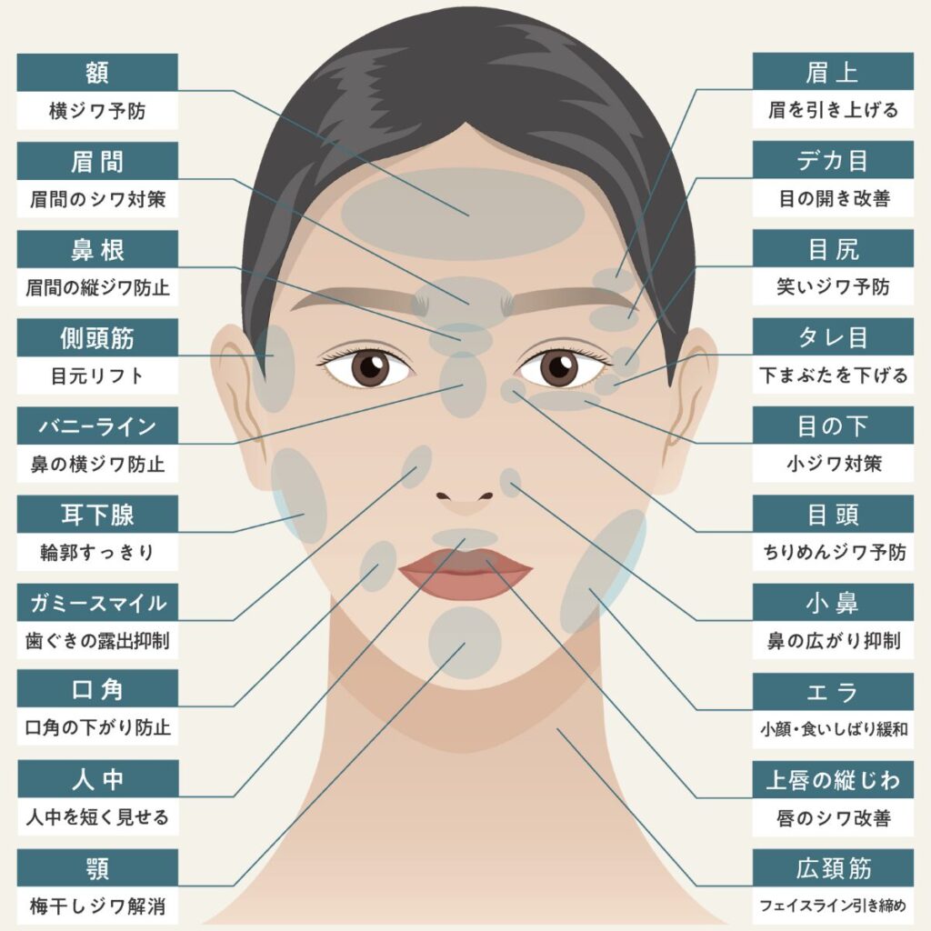 ボトックス注射（アラガン・ボツラックス） でシワ改善｜原宿・明治神宮前｜CHINOWA CLINIC
